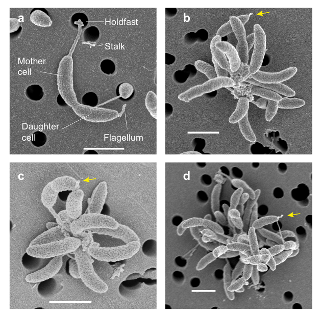 Research | Biological Fluids and Complex Mechanics Lab